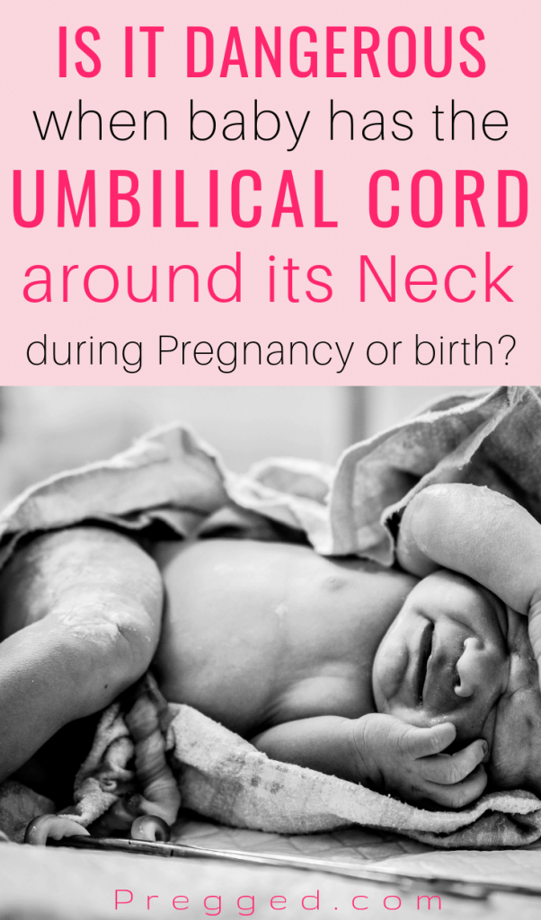 Is It Dangerous If Baby Has The Umbilical Cord Around Neck Pregged Is It Dangerous If Baby Has The Umbilical Cord Around Neck Pregged